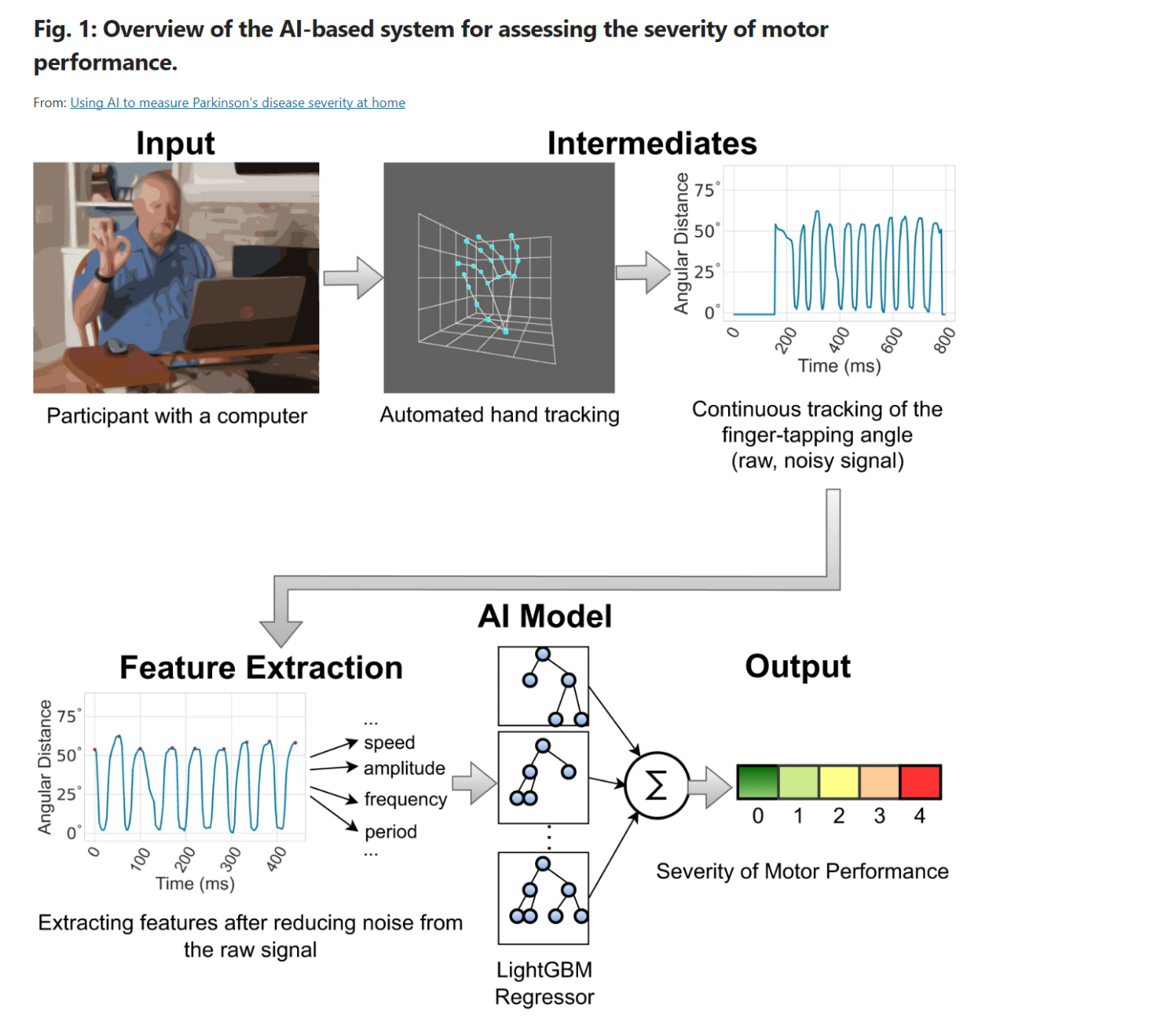 AI powered hand test to rate Parkinson’s severity | Parkinsons NSW